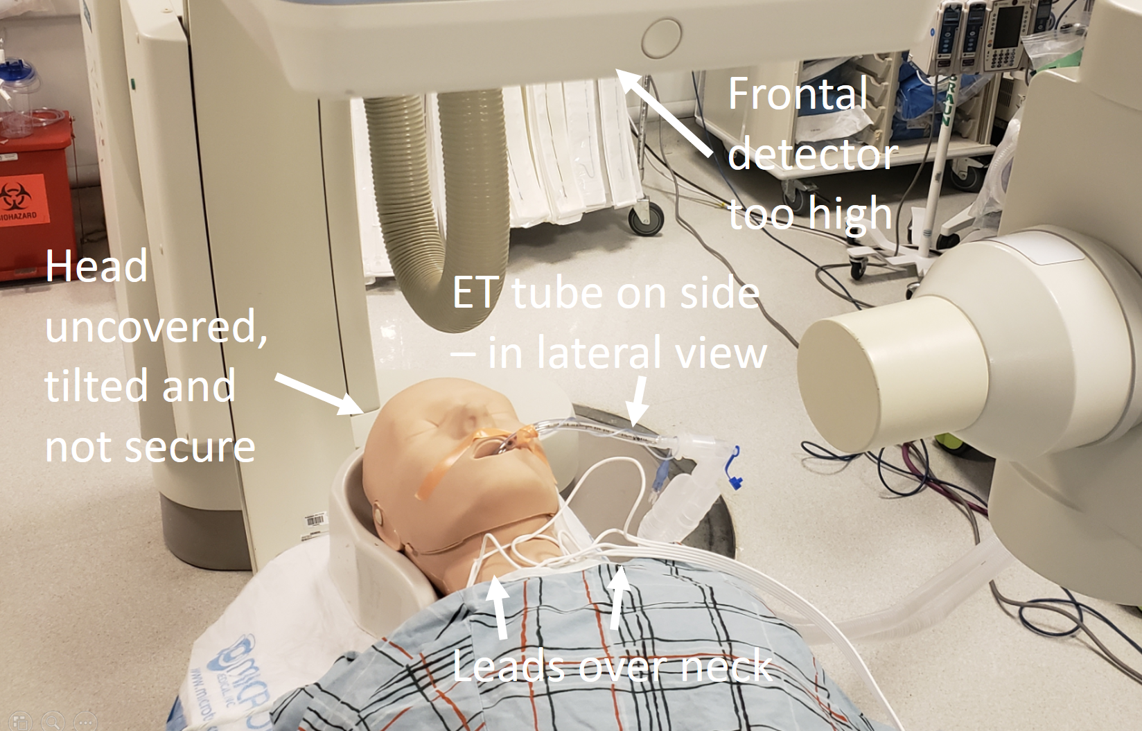 The Art Of Cerebral Angiography